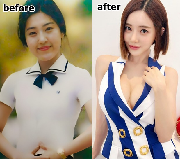 【昔の画像44枚】DJSODAは豊胸と整形？豊胸跡や偽乳説を検証！ | 裏芸能ニュース